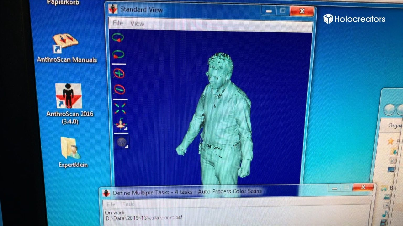 Vitronic Vitus 3D body scanner Product Review